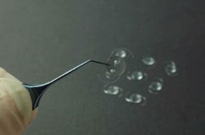 What Is LAL Eye Surgery? Light Adjustable Lens Explained